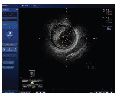 Innovations - Cardiac Interventions Today