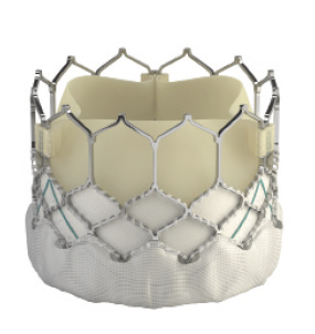 Innovations - Cardiac Interventions Today
