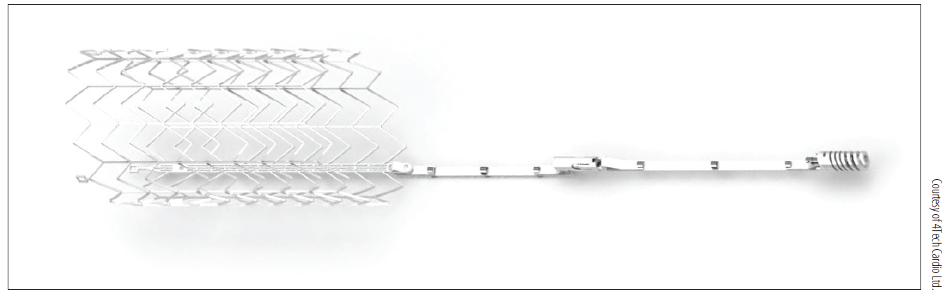 The Next Frontier of Percutaneous Tricuspid Valve Repair - Cardiac ...
