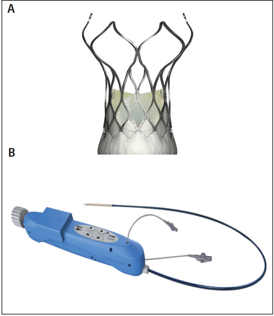 Aortic Valves: What's Coming? - Cardiac Interventions Today