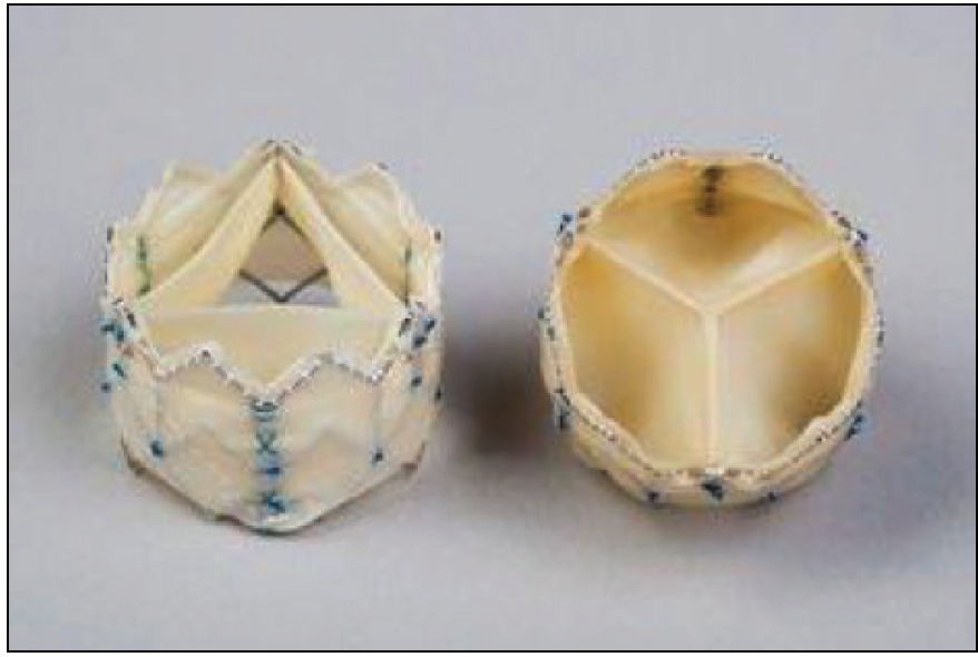 Aortic Valves: What's Coming? - Cardiac Interventions Today