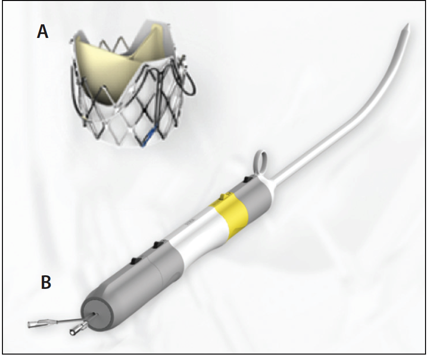 Aortic Valves: What's Coming? - Cardiac Interventions Today