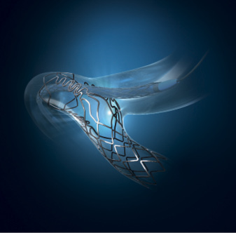 Innovations - Cardiac Interventions Today