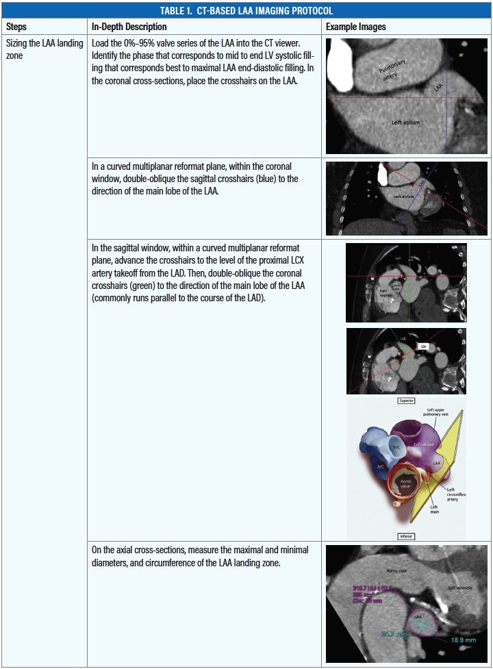 Assessing Anatomy for Left Atrial Appendage Closure - Cardiac ...