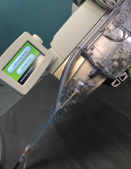 Robotic PCI Technologies - Cardiac Interventions Today