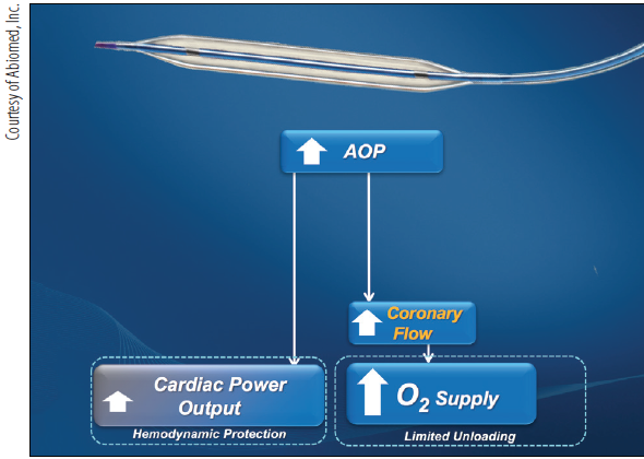 Selection of Hemodynamic Support: An Approach for Coronary ...