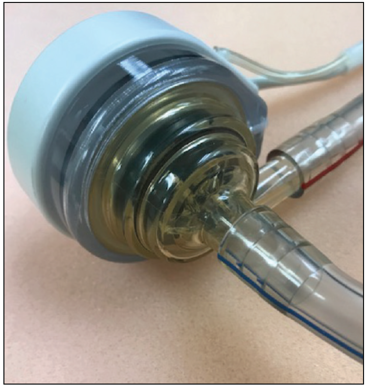 Right Ventricular Support Options - Cardiac Interventions Today