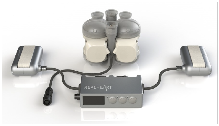 The Next Wave of Mechanical Circulatory Support Devices - Cardiac ...