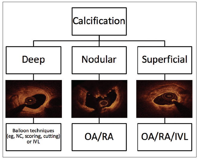 Precision PCI: Making the Complex Simple or the Simple Complex ...