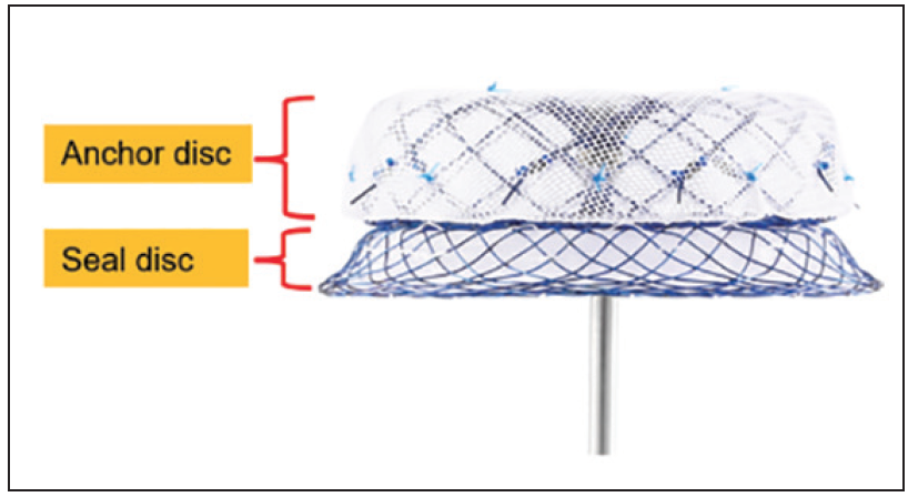 Update on Left Atrial Appendage Occlusion - Cardiac Interventions Today