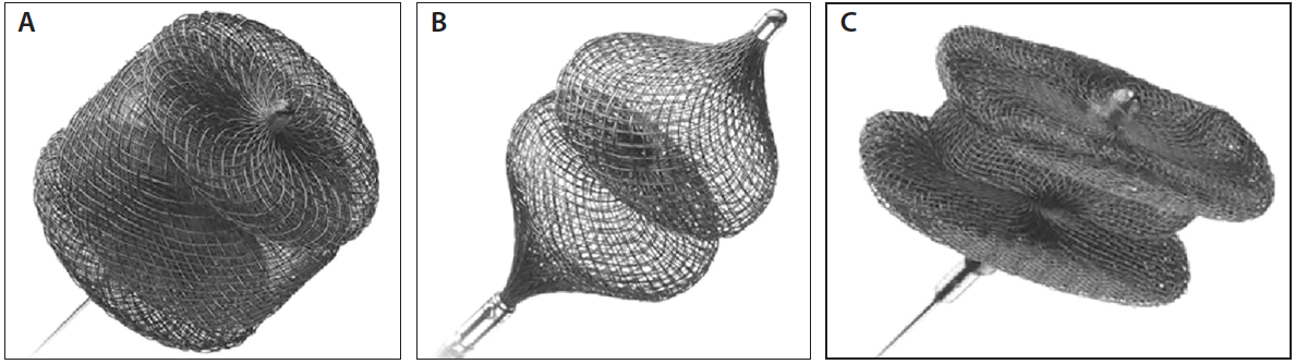 Transcatheter Paravalvular Leak Closure: Diagnosis, Devices, Techniques ...