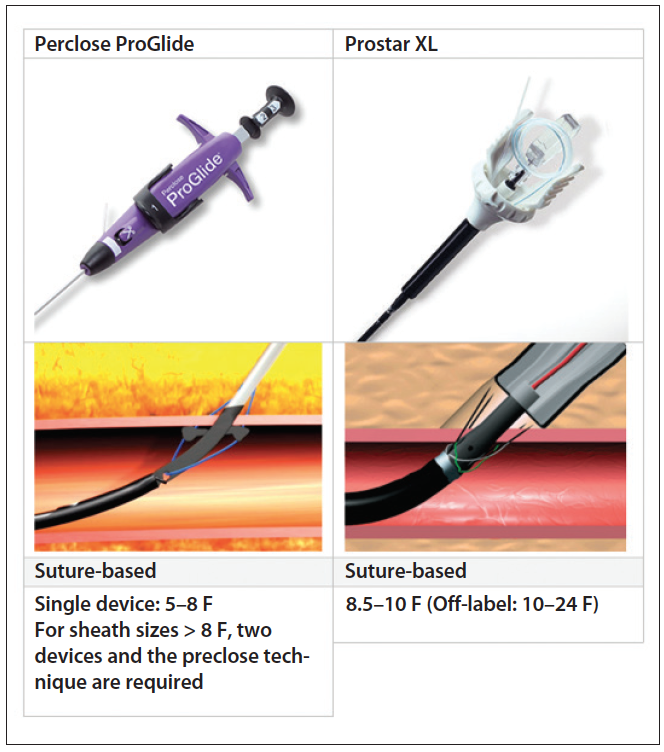 Large-Bore Access Closure: The Current Landscape - Cardiac ...