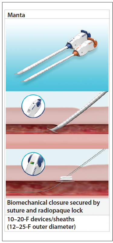 Large-Bore Access Closure: The Current Landscape - Cardiac ...