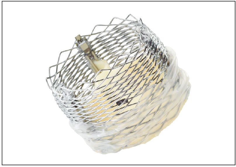 The LOTUS Edge Aortic Valve System and SENTINEL Cerebral Protection ...