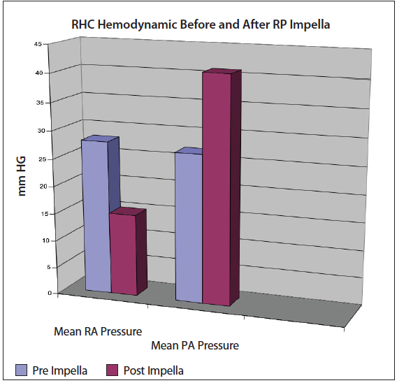 EkoSonic Endovascular System and RP Impella Support Acute Right Ventricular Failure From Massive ...
