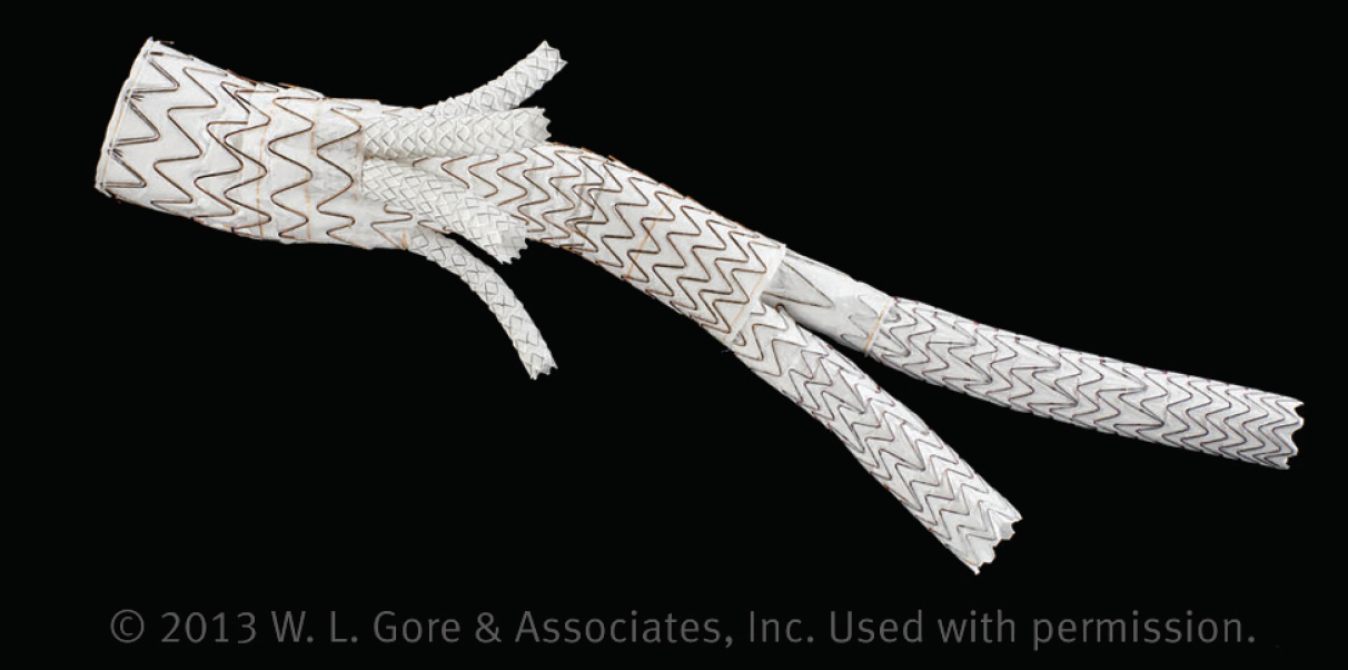 Tested by Time - Endovascular Today