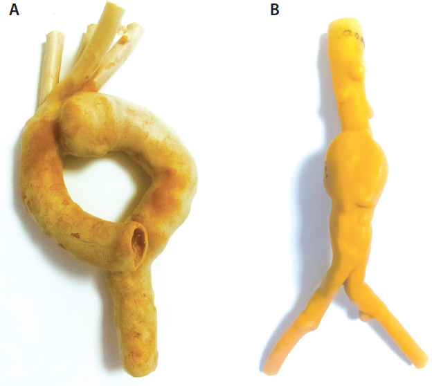 EVAR 2020: Training Future Aortic Specialists - Endovascular Today