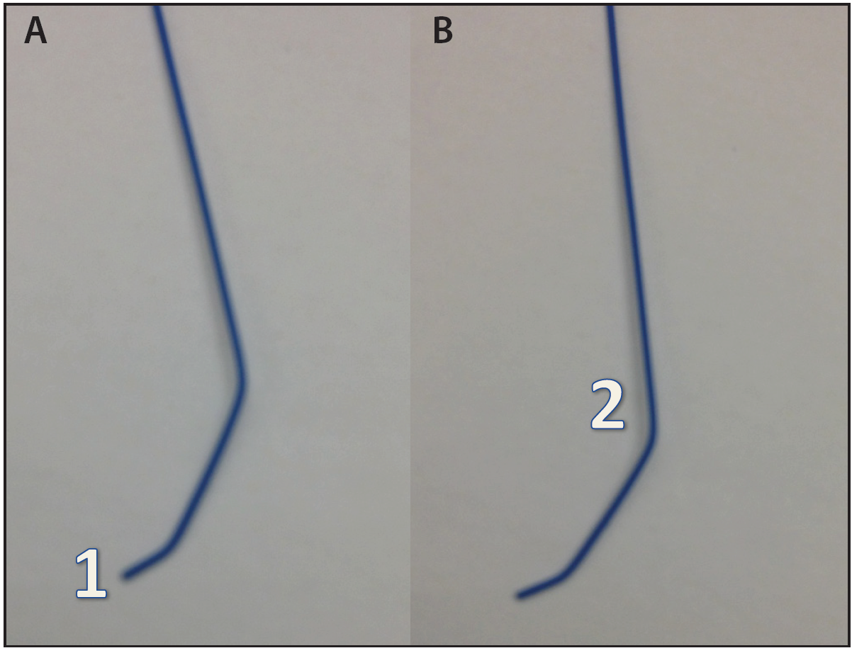 Guidewire Selection in Critical Limb Ischemia: Road Map to Success ...