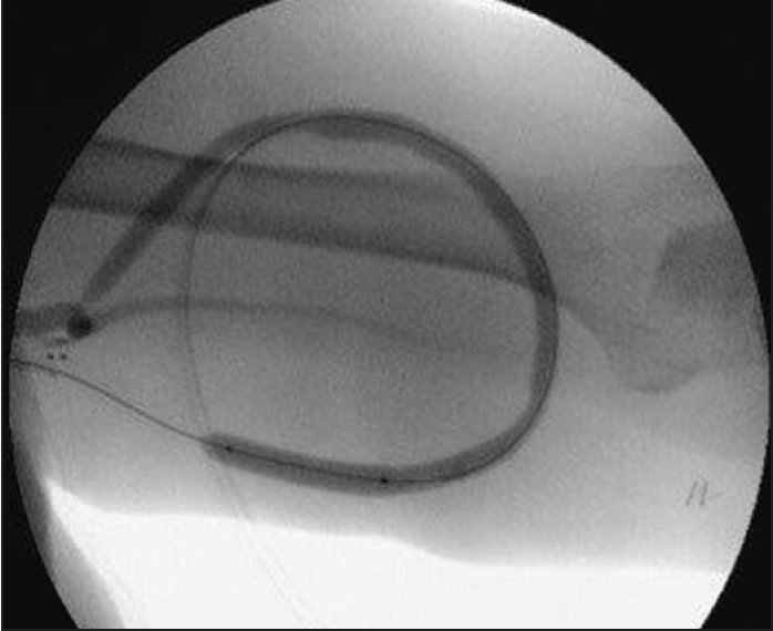 Introducing Chameleon™: The Next Generation of PTA Balloons ...