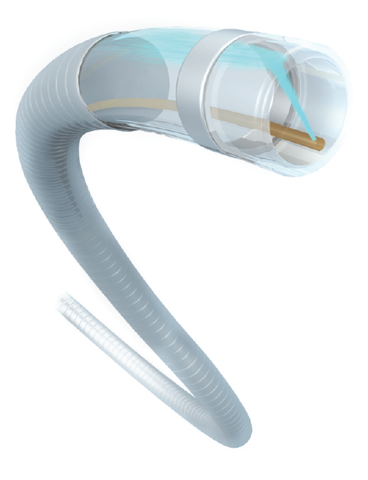 Innovations - Endovascular Today