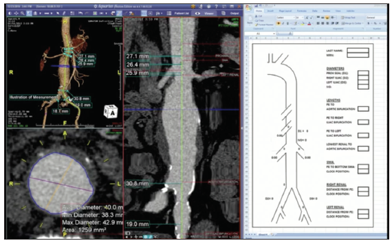 Ten Steps - Endovascular Today
