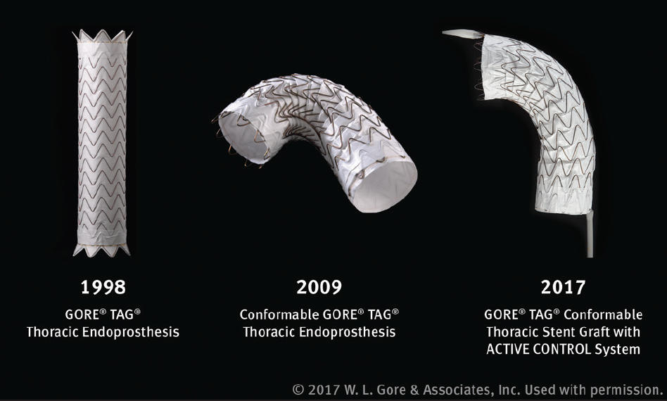 Early Results and Lessons Learned With the GORE® TAG® Conformable ...