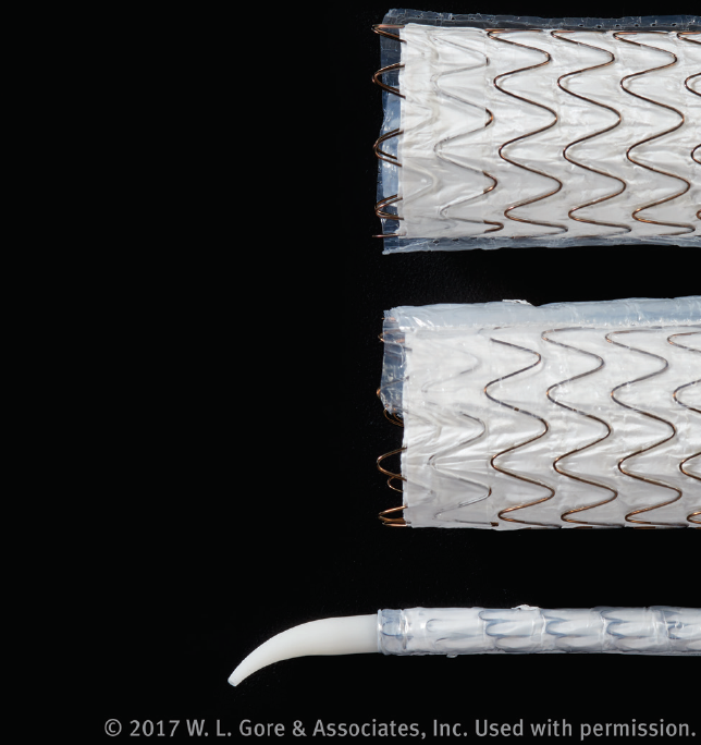 Early Results and Lessons Learned With the GORE® TAG® Conformable ...