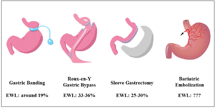 Bariatric Embolization: Are Patients Actually Losing Weight ...