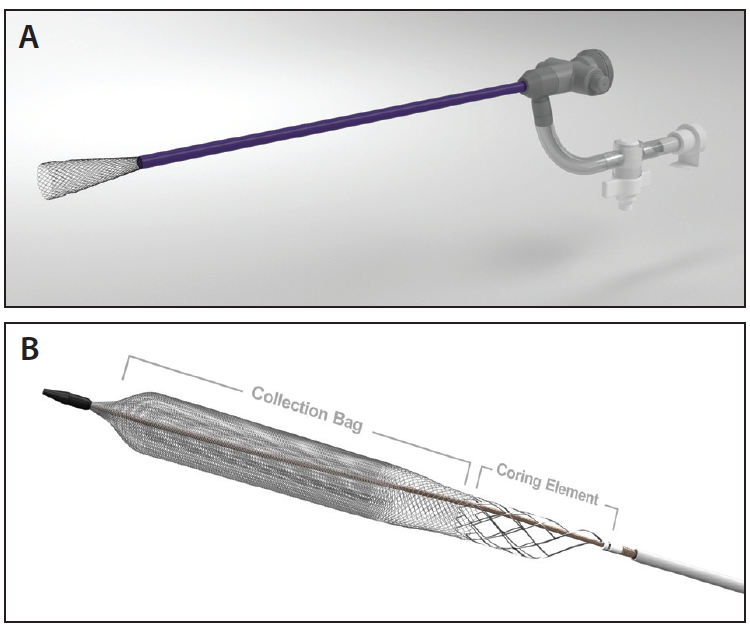 Acute DVT: Are We Overtreating or Undertreating? - Endovascular Today