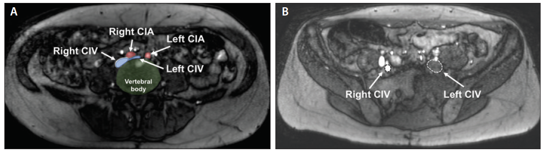 Diagnosing Deep Venous Disease Through Optimized Imaging: Magnetic ...
