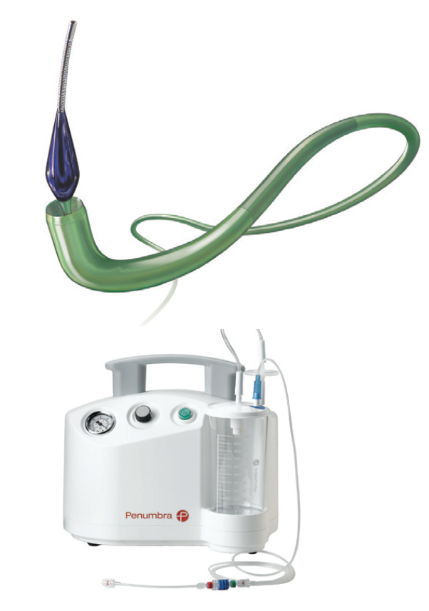 Indigo System for Thromboembolic Disease - Endovascular Today