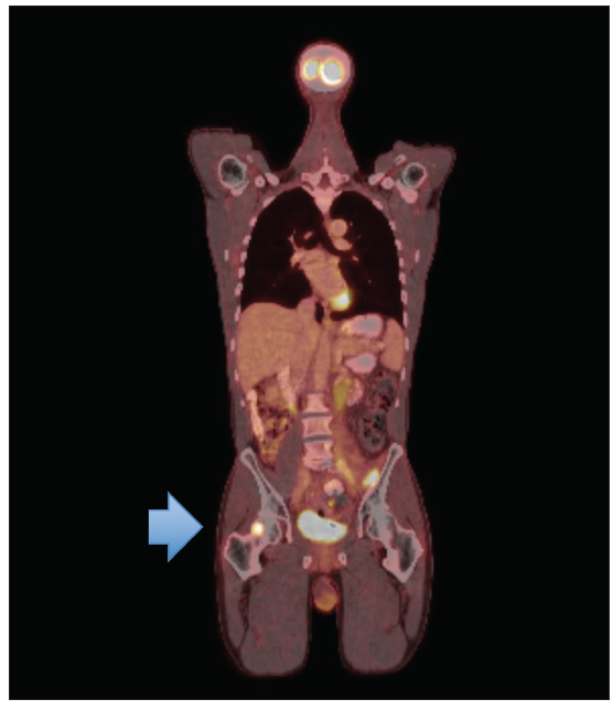 Identifying the Right Diagnosis at the Right Time - Endovascular Today