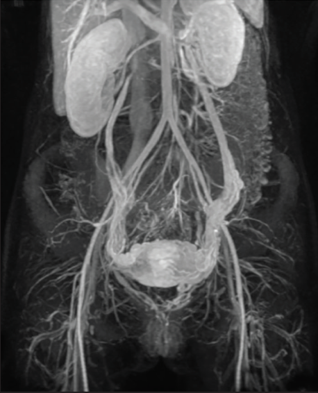 Ruby, POD, and POD Packing Coil: Dedicated Devices for Different ...