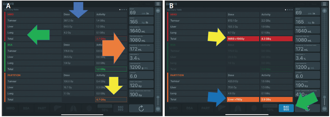 What's New in Y-90? - Endovascular Today