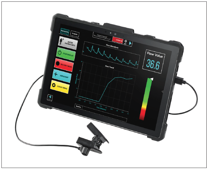 Intraprocedural Monitoring of Blood Flow Using FlowMet-R - Endovascular ...