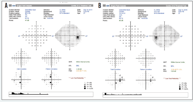 Small Eye, Big Pressure - Glaucoma Today