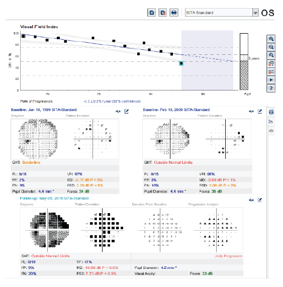 Am I Getting Worse, Doc? - Glaucoma Today