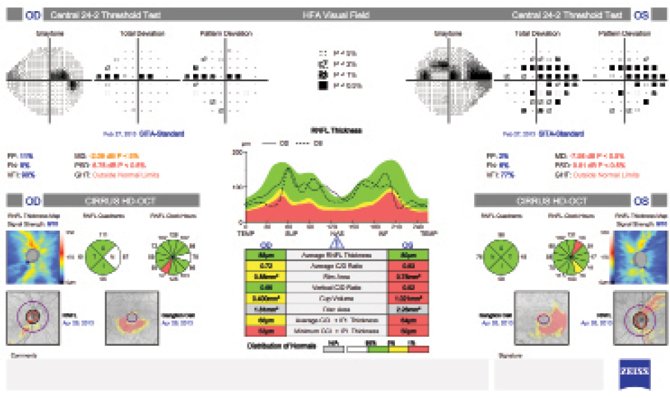 Structure And Function In Clinical Practice Glaucoma Today