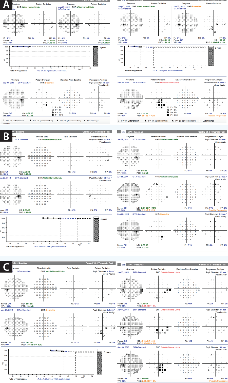 Do We Need Perimetry? - Glaucoma Today