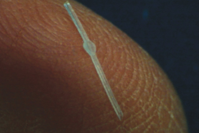 Making Subconjunctival Filtration Surgery Great Again? - Glaucoma Today