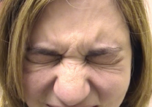 A Woman with Muscle Stiffness - Practical Neurology