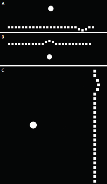 Home Monitoring of Dry AMD Patients - Retina Today