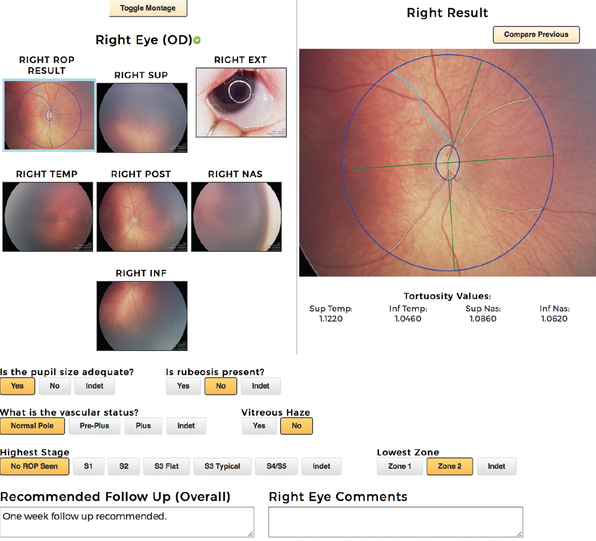 Telemedicine in Ophthalmology - Retina Today