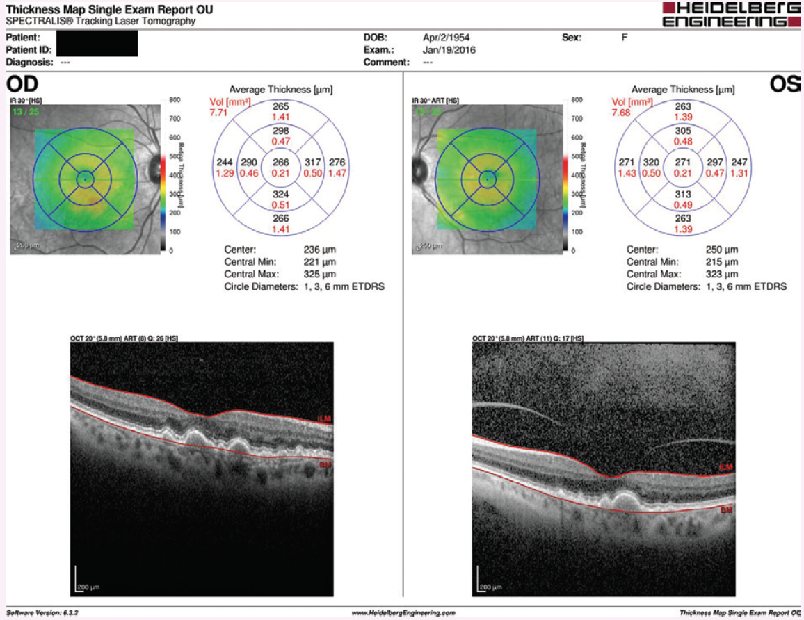 Putting Vision Monitoring in the Hands of Patients With AMD - Retina Today