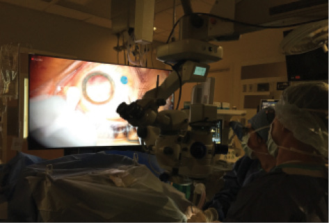 Future Trends in Pediatric Vitrectomy - Retina Today