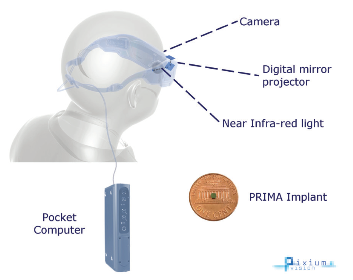 Retina News - Retina Today