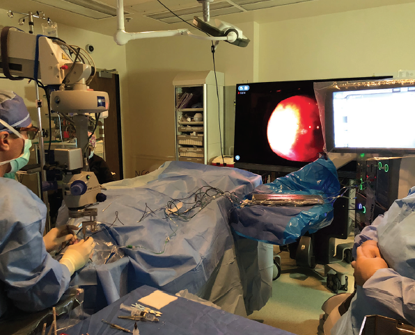 Real-World Experience With 3D Surgical Viewing - Retina Today