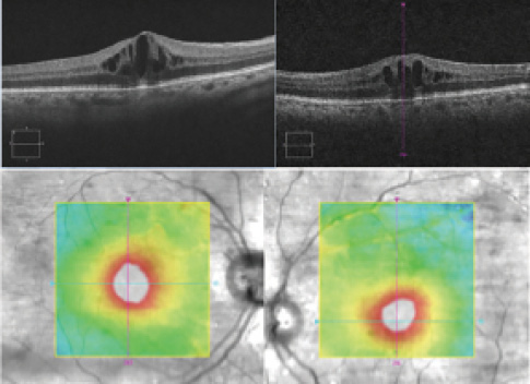 Graying Eyelashes, Hearing Loss, and Blurry Vision: Aging or ...