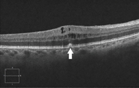 Graying Eyelashes, Hearing Loss, and Blurry Vision: Aging or ...