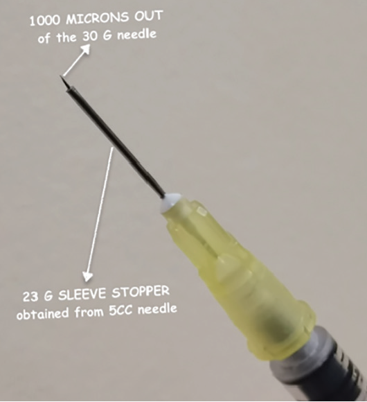 The Mother of Invention: Making Custom Equipment in Syria - Retina Today